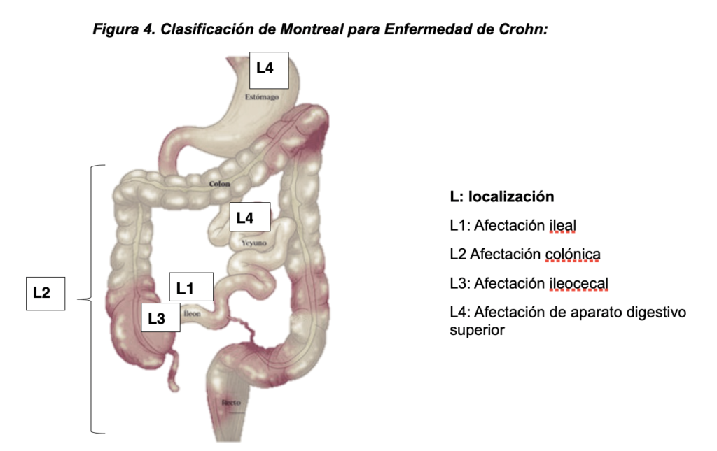Conociendo la Enfermedad Inflamatoria Intestinal – Vivir con Crohn y Cuci
